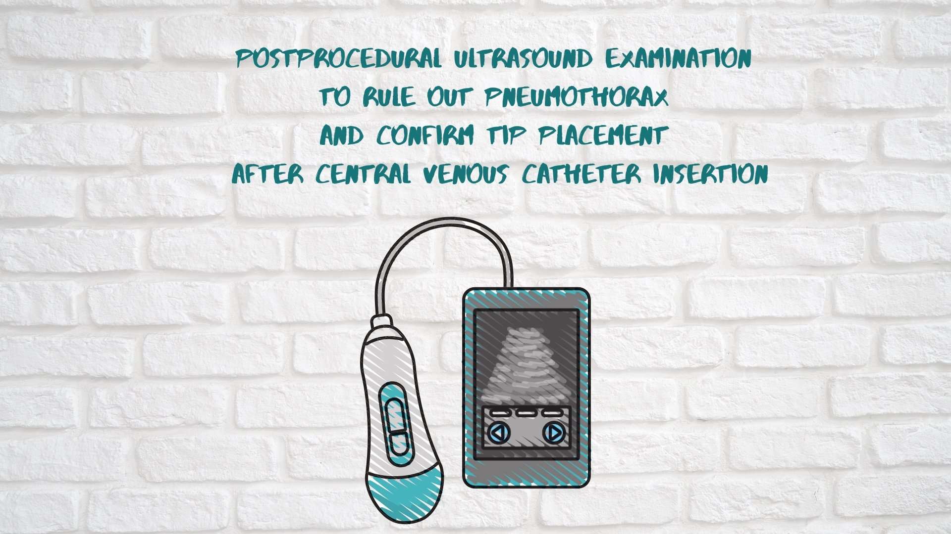Post-procedural ultrasound examination to rule out pneumothorax and ...